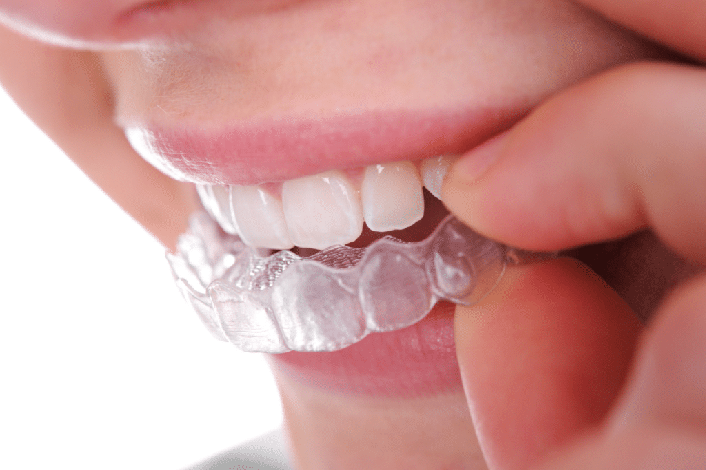 Invisalign and Coffee Cravings: A Practical Approach in Hanover PA and ...